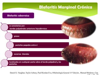 Blefaritis, Orzuelo y Chalazión | PPTX