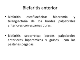 Blefaritis marginal cronica | PPT
