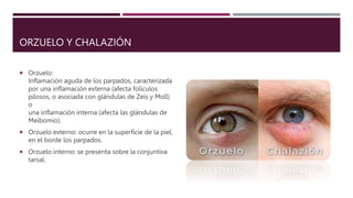 Blefaritis, orzuelo, chalazión.pptx