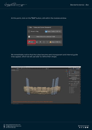 Blenderfordental iBar Guide - Vladyslav Pereverzyev.pdf