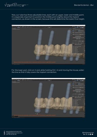 Blenderfordental iBar Guide - Vladyslav Pereverzyev.pdf