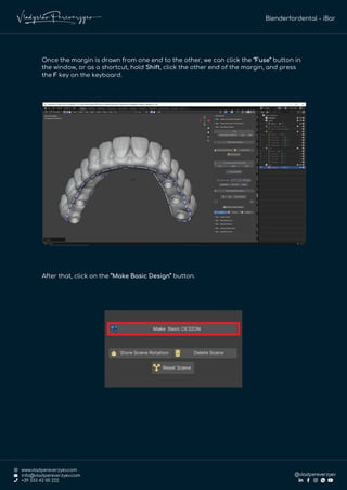 Blenderfordental iBar Guide - Vladyslav Pereverzyev.pdf