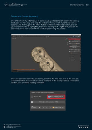 Blenderfordental iBar Guide - Vladyslav Pereverzyev.pdf