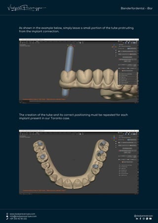 Blenderfordental iBar Guide - Vladyslav Pereverzyev.pdf
