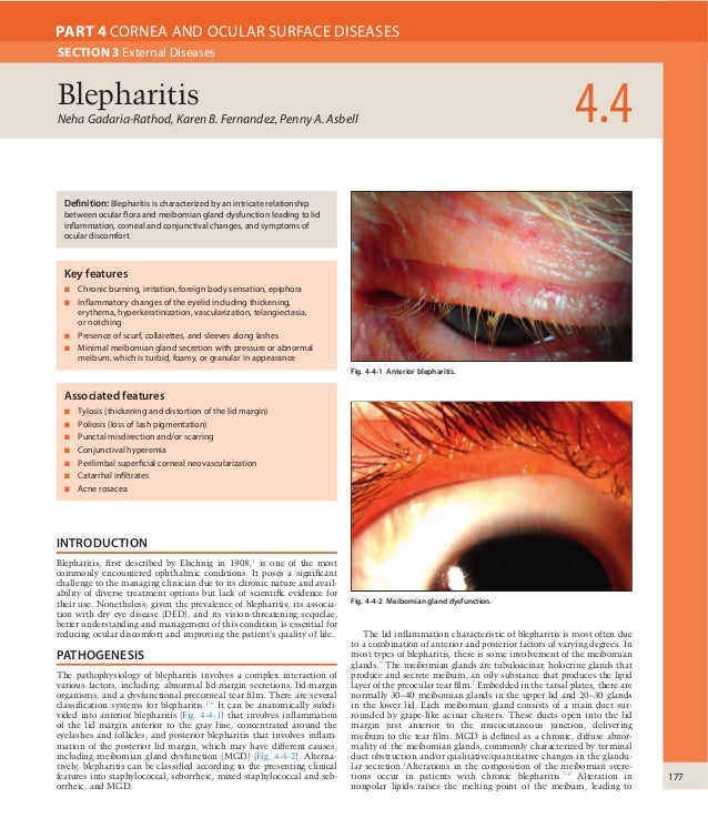 Blepharitis