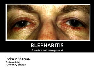 Blepharitis : Overview and management | PPTX