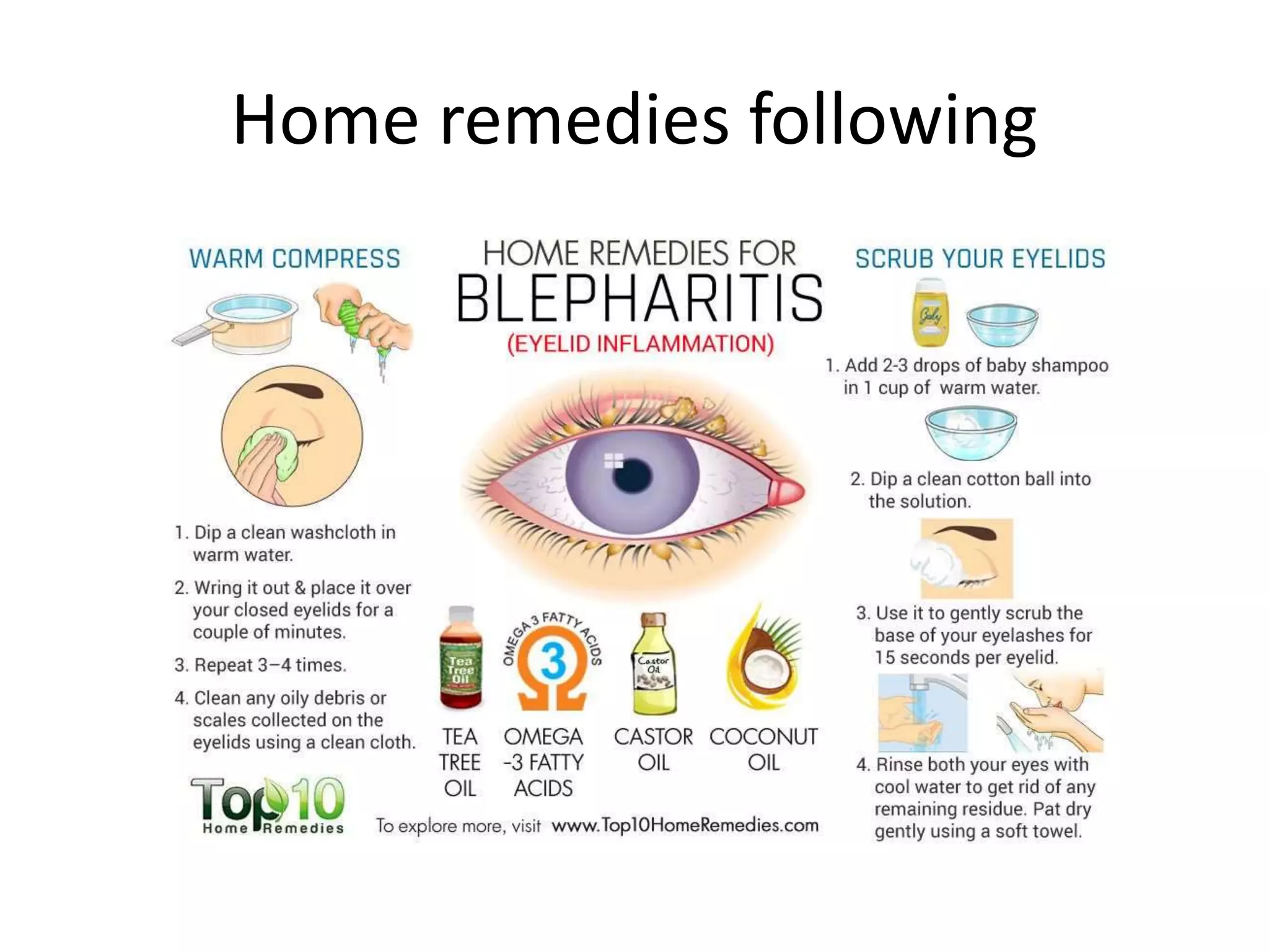 Blepharitis | PPTX