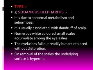 Blepharitis | PPTX