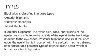 Blepharitis | PPTX