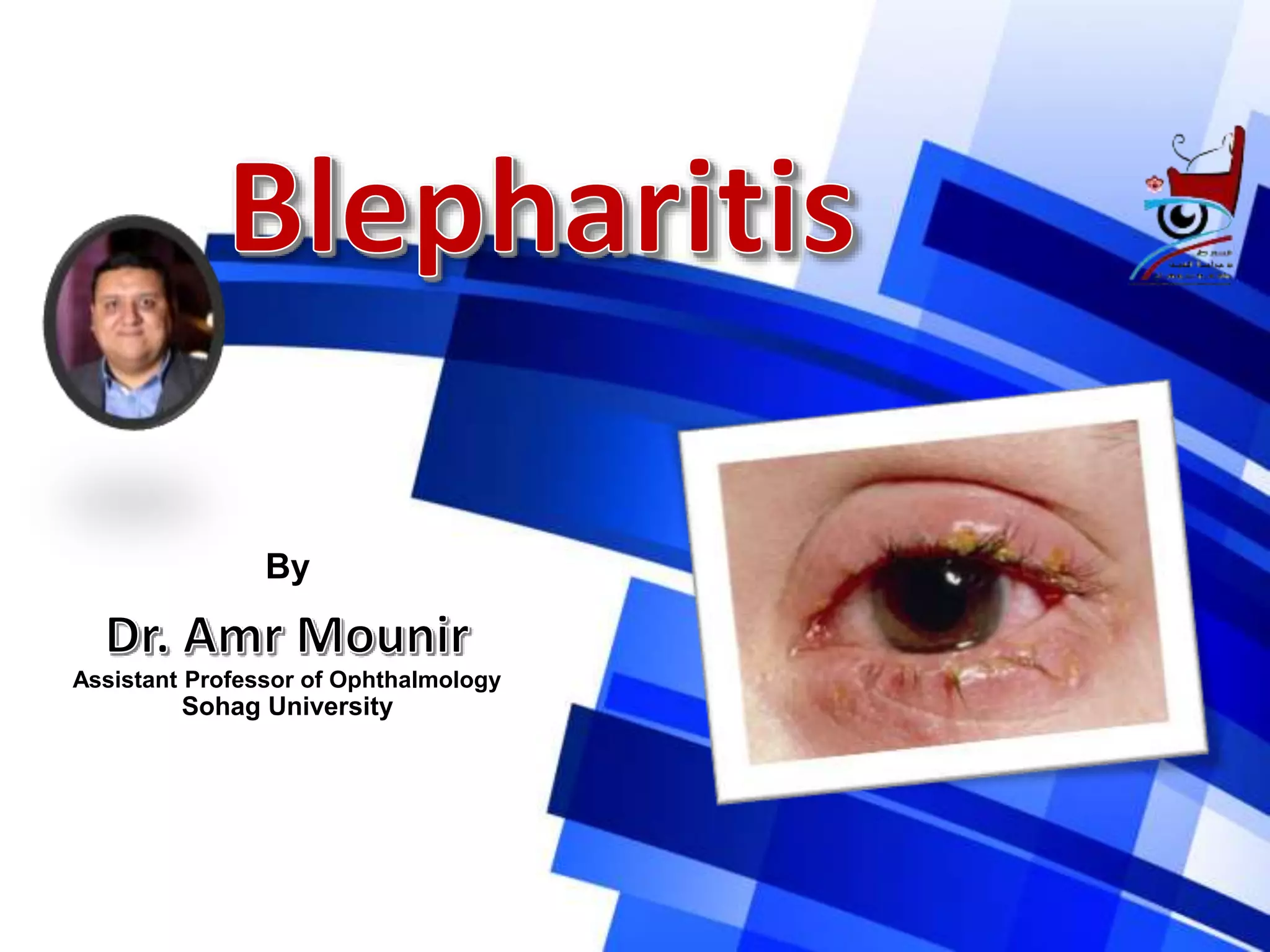 Blepharitis | PPTX