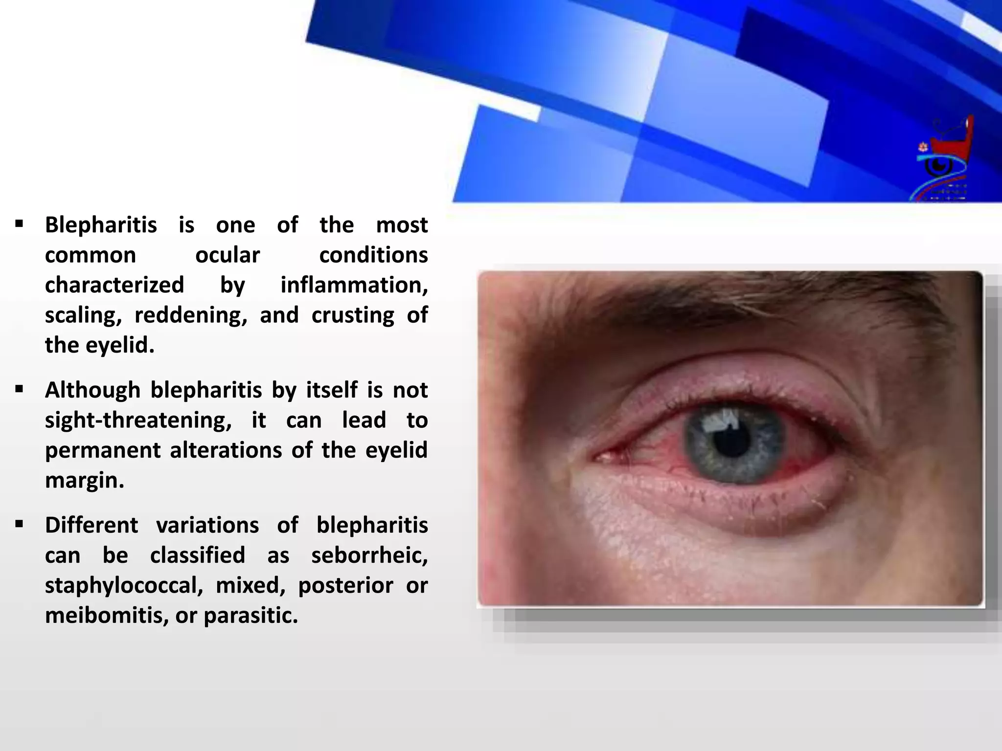Blepharitis | PPTX