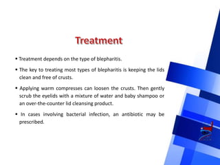 Ulcerative Blepharitis Treatment