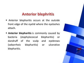Blepharitis | PPTX