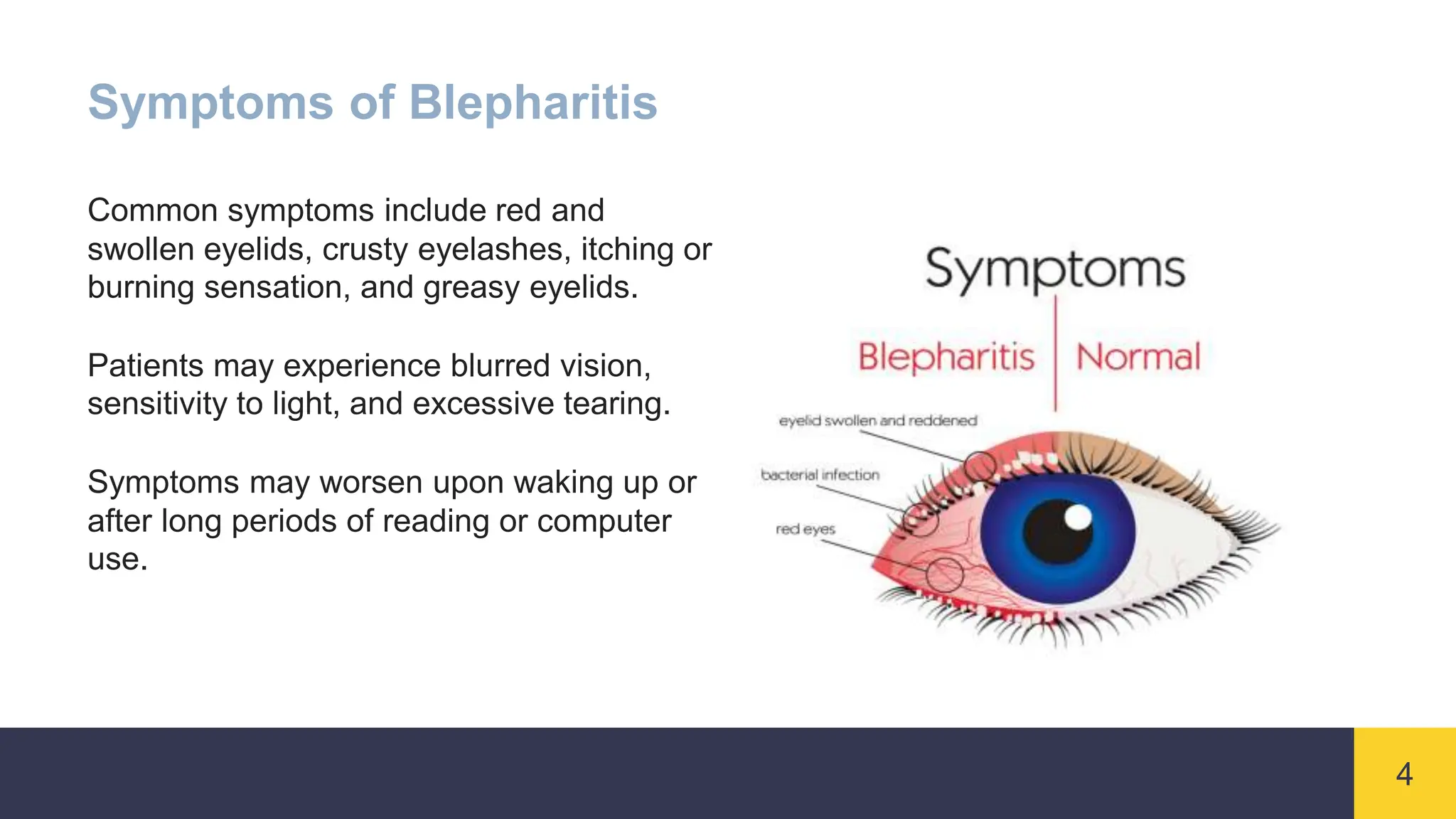 Blepharitis inflammation of eyelid symptoms cause everything included ...