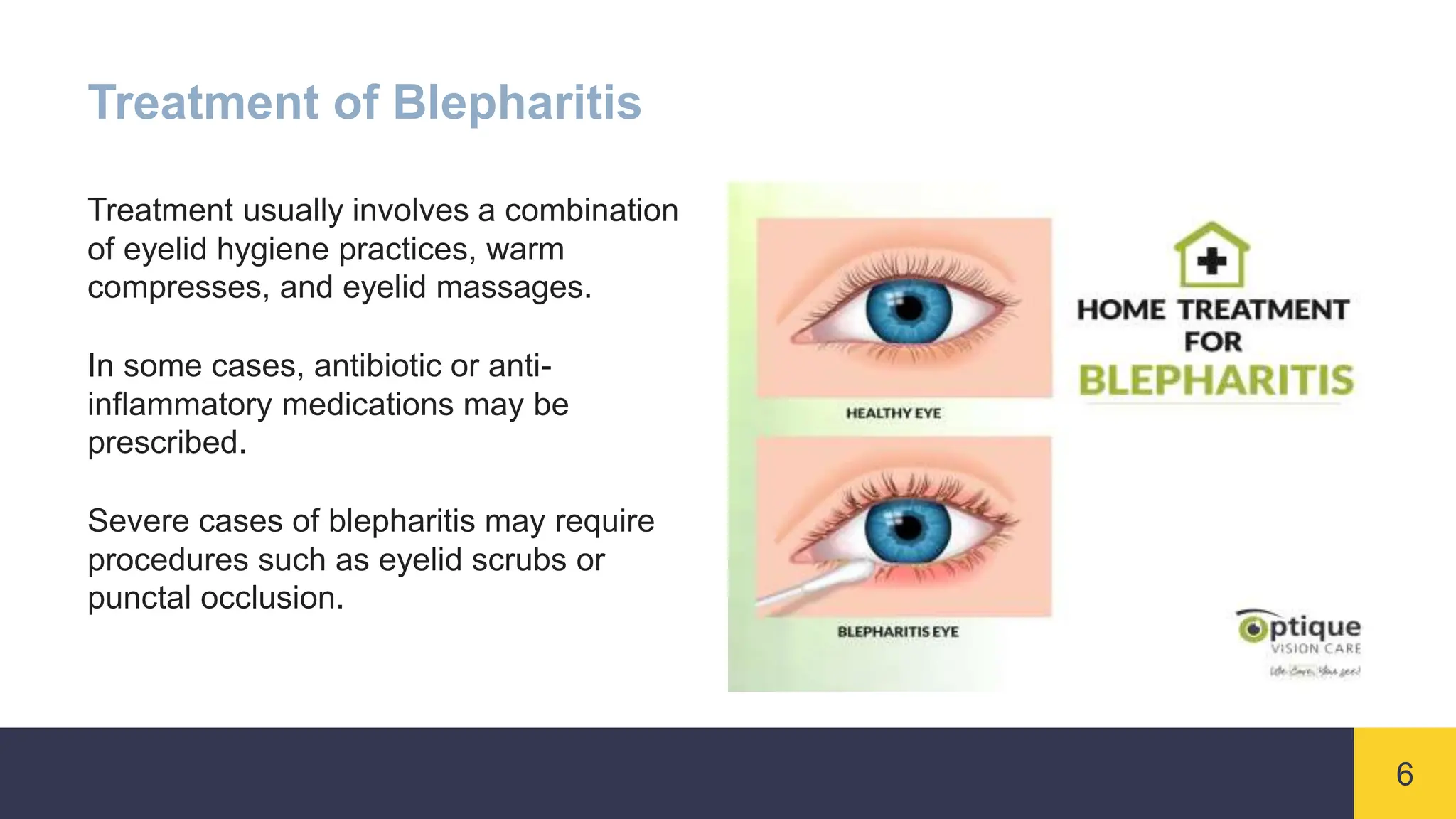 Blepharitis inflammation of eyelid symptoms cause everything included along with the pictures | PPTX