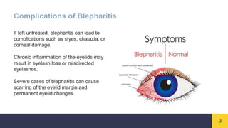 Blepharitis inflammation of eyelid symptoms cause everything included along with the pictures | PPTX