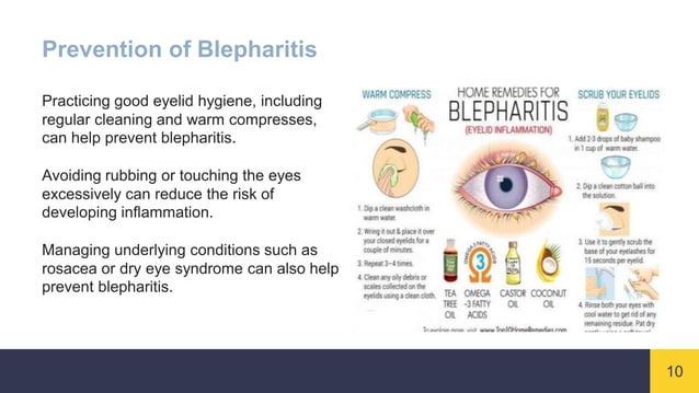 Blepharitis inflammation of eyelid symptoms cause everything included ...