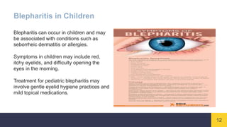 Blepharitis inflammation of eyelid symptoms cause everything included ...