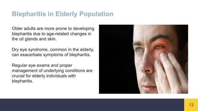 Blepharitis inflammation of eyelid symptoms cause everything included ...