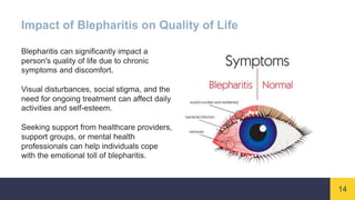 Blepharitis inflammation of eyelid symptoms cause everything included ...
