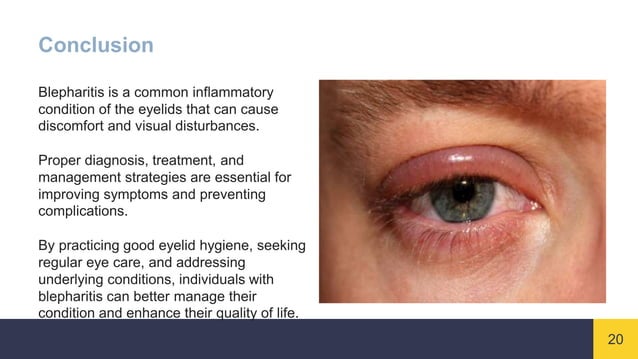 Blepharitis inflammation of eyelid symptoms cause everything included ...