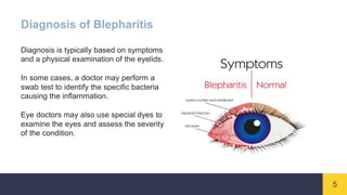 Blepharitis inflammation of eyelid symptoms cause everything included along with the pictures | PPTX