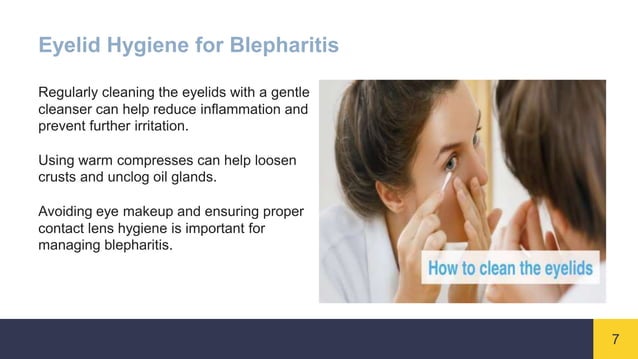 Blepharitis inflammation of eyelid symptoms cause everything included ...