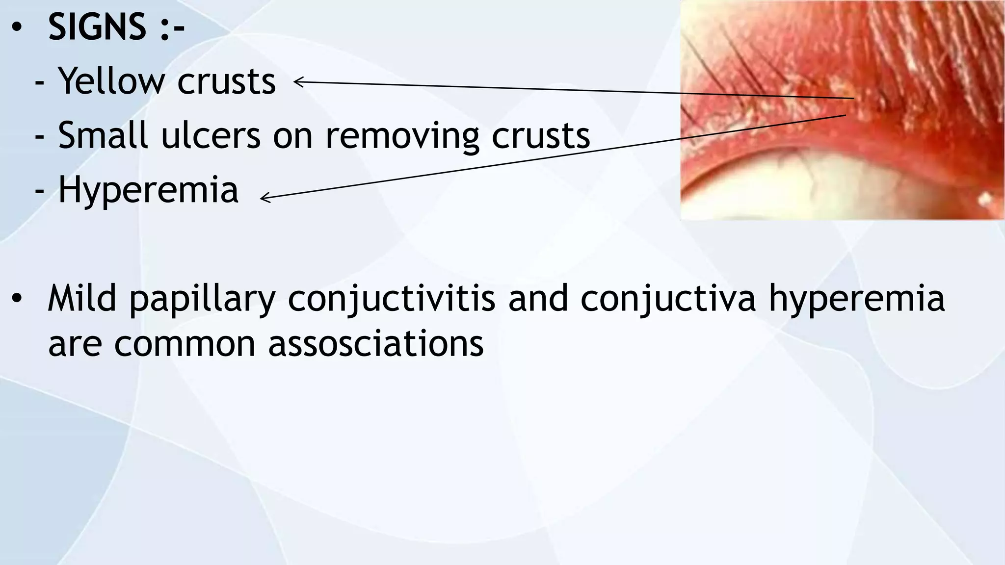 Blepharitis | PPTX