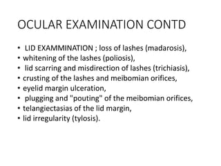 BLEPHARITIS-WPS Office.pptx.ppt