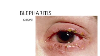 BLEPHARITIS [Autosaved] group 32.pptx yyuhyyy | PPTX