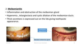 Case report-Blepharitis | PPTX
