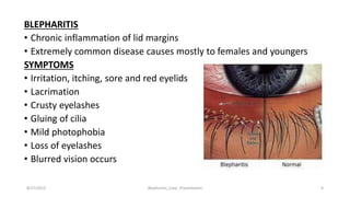 Case report-Blepharitis | PPTX