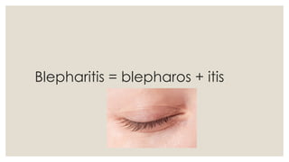 Blepharitis clinical features and management ppt | PPTX