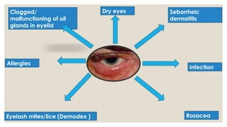 Blepharitis clinical features and management ppt | PPTX