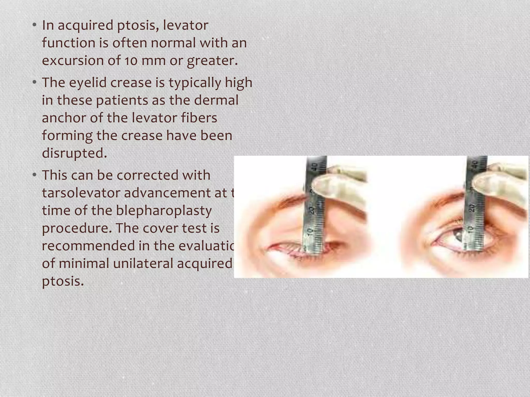 Blepharoplasty | PPTX