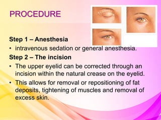 Blepharoplasty | PPTX