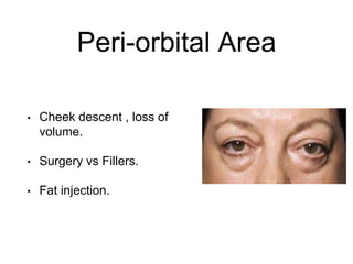 Blepharoplasty plastic meeting talk | PPTX