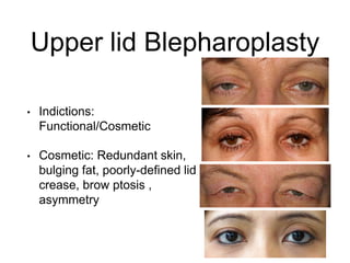 Blepharoplasty plastic meeting talk | PPTX