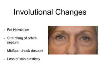 Blepharoplasty plastic meeting talk | PPTX