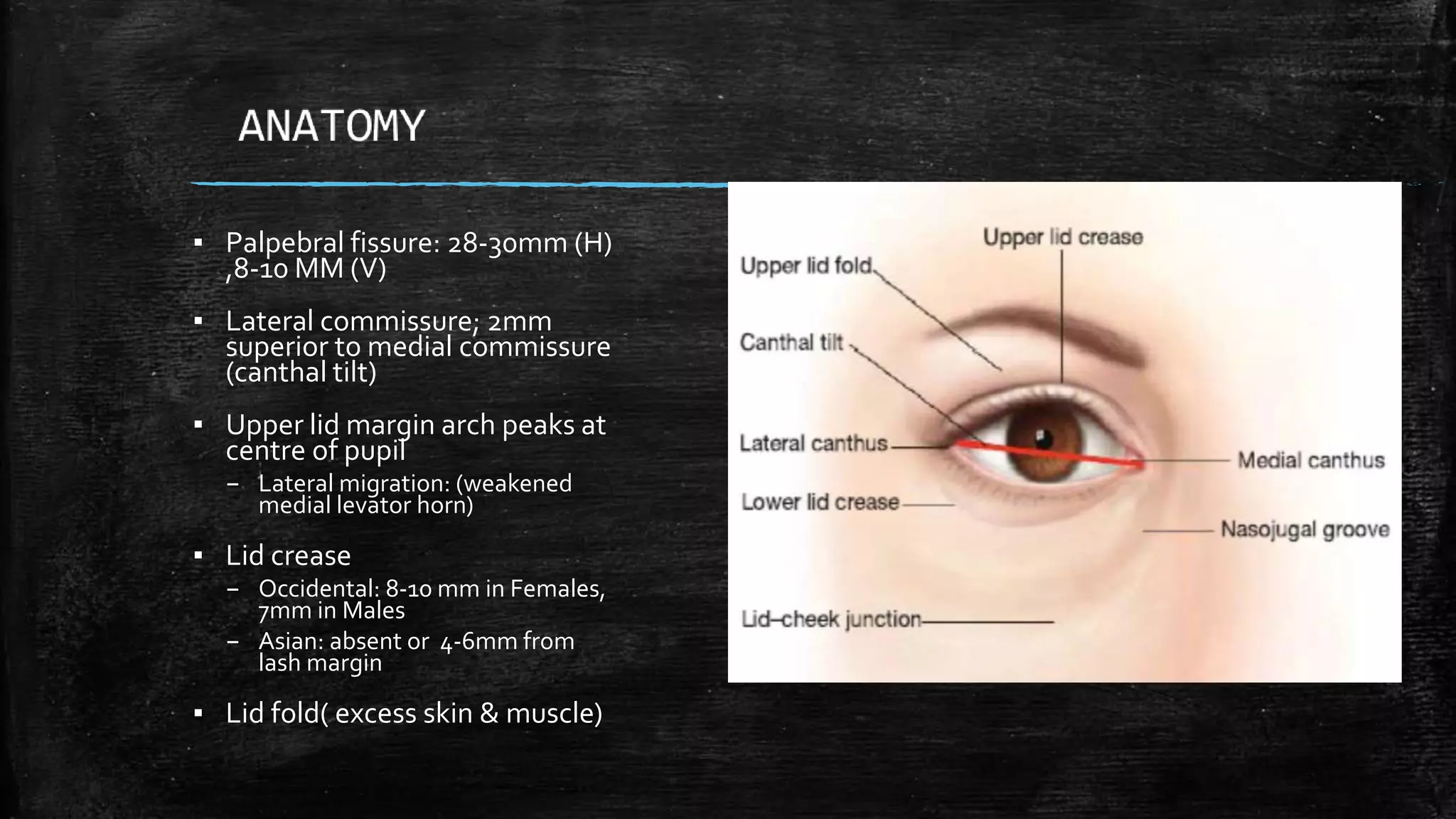 Blepharoplasty | PPTX