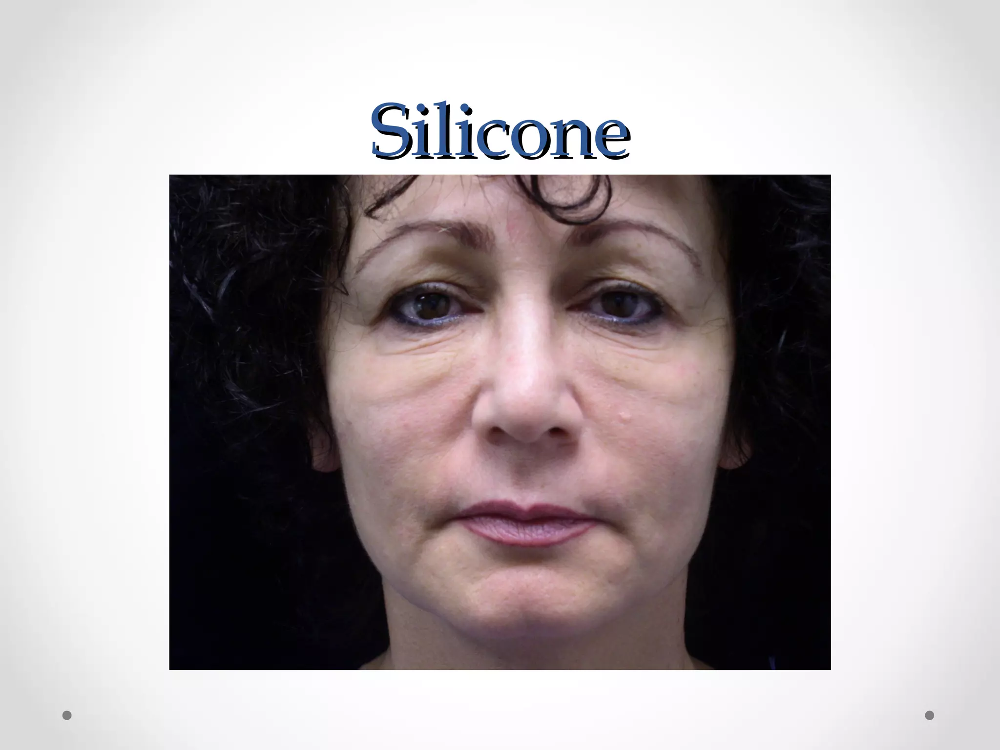 Blepharoplasty techniques | PPT