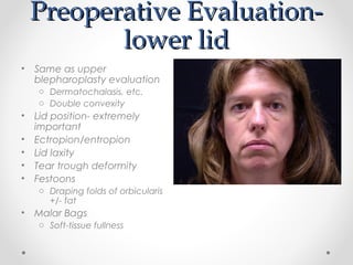 Blepharoplasty techniques | PPT