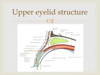Blepheroptosis - HARSH AMIN ( plastic & cosmetic surgeon ) | PPTX
