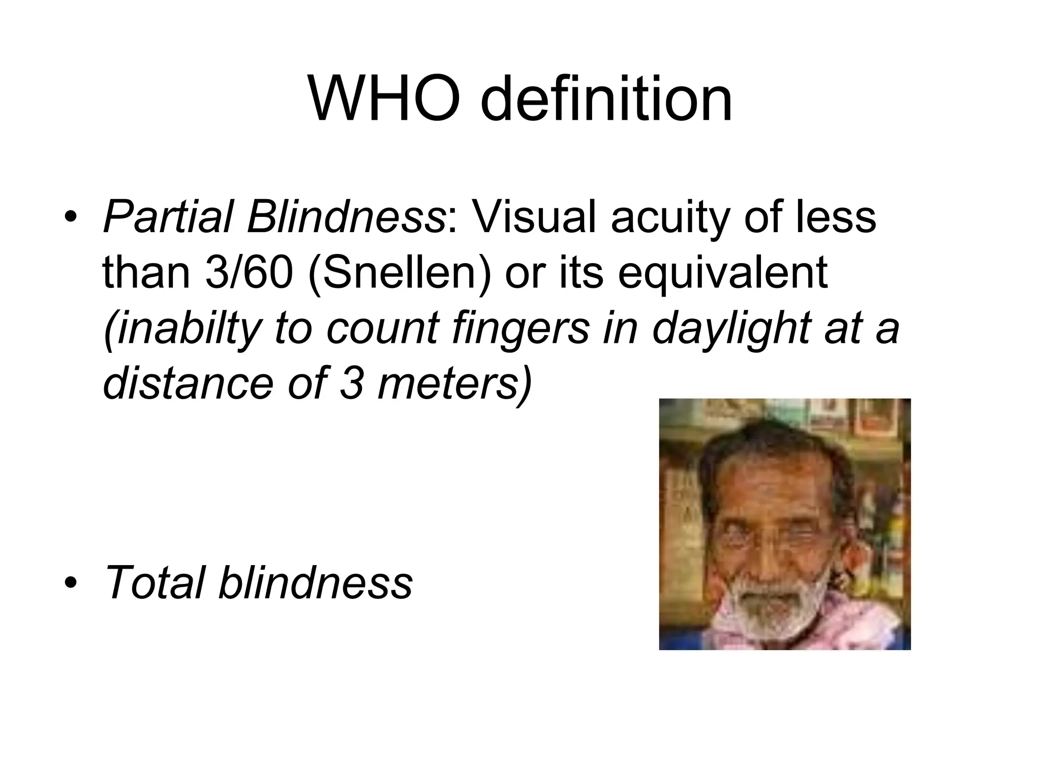 Causes of Blindness | PPTX