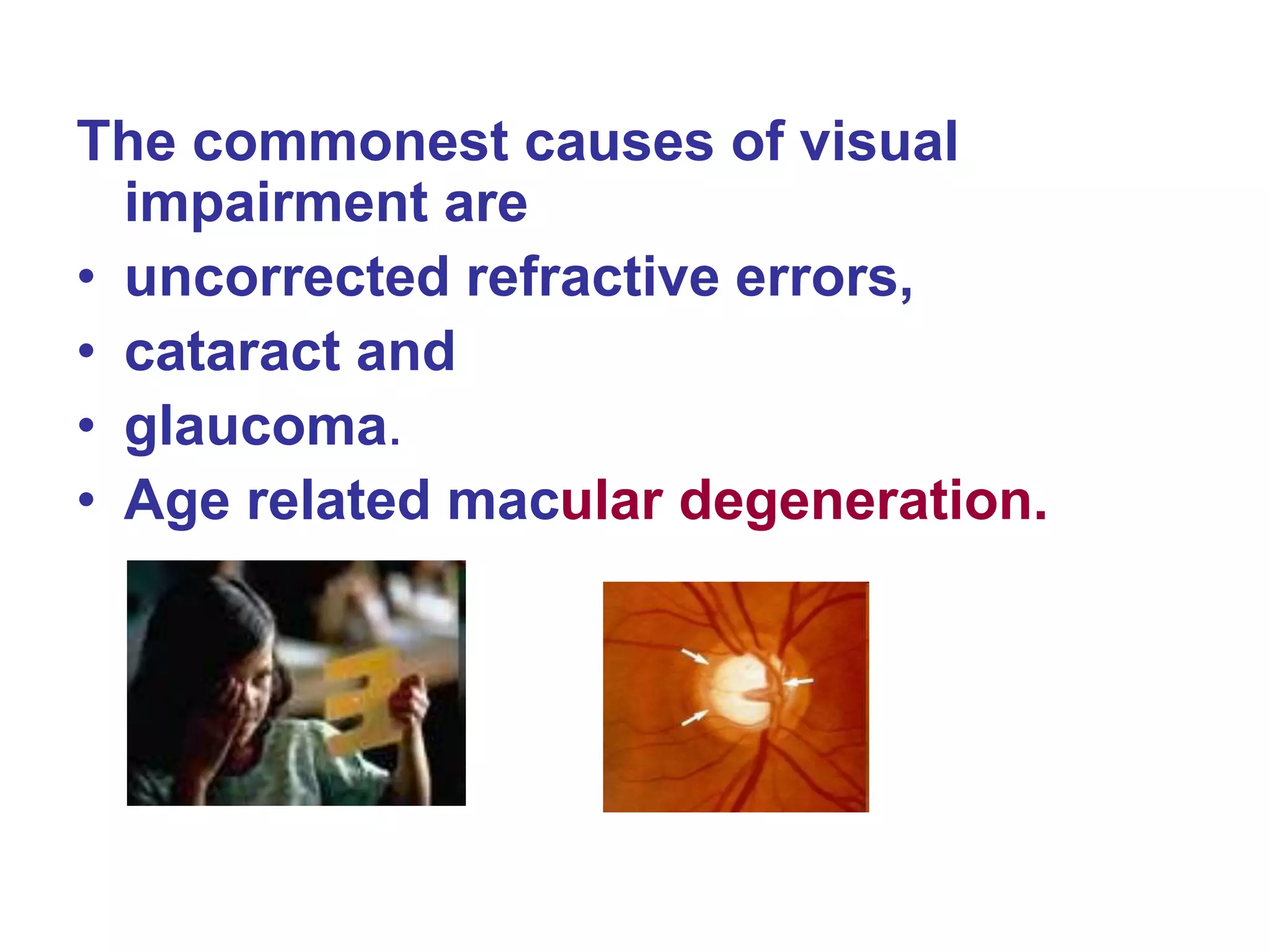 Causes of Blindness | PPTX
