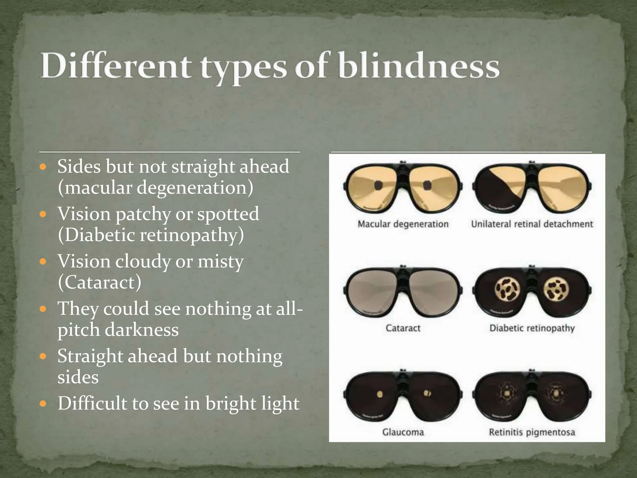 Blindness and deafness a common problem of children | PPTX