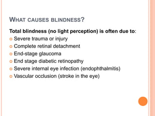 Blindness and its management | PPTX
