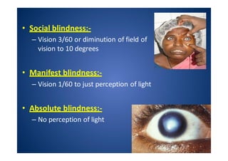 BLINDNESS program ppt | PDF