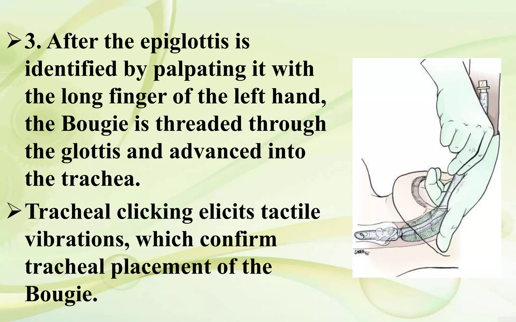Blind oral and nasal intubation | PPTX