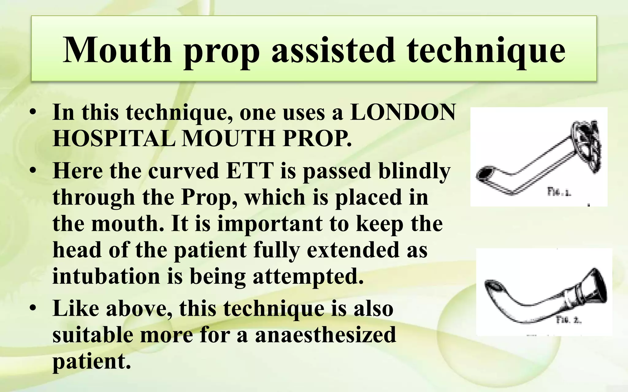 Blind oral and nasal intubation | PPTX